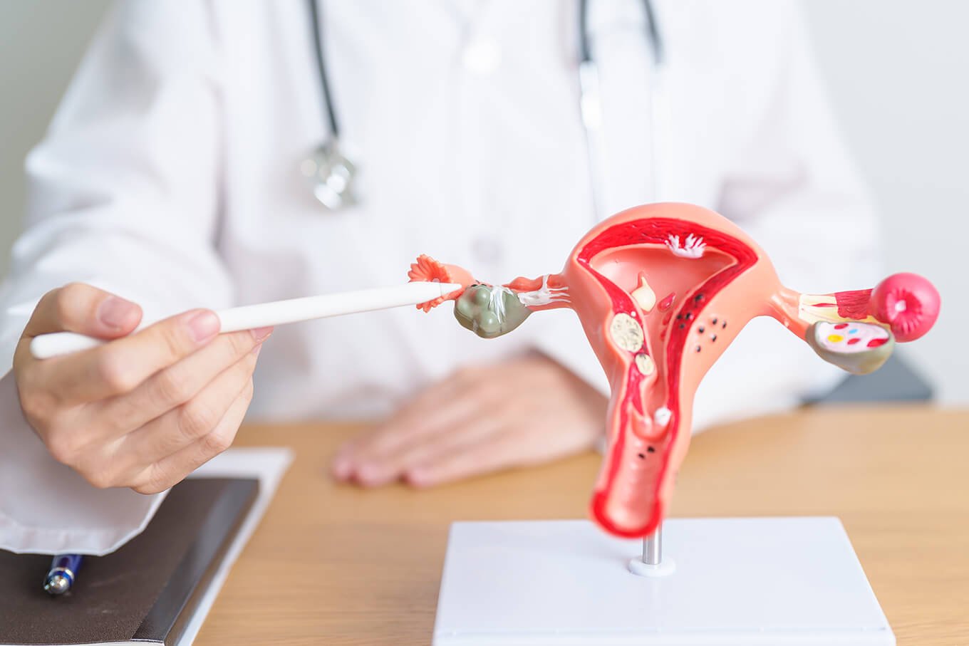 Ovarios Poliquísticos Síntomas Tratamiento Y Dieta Clínica 9078
